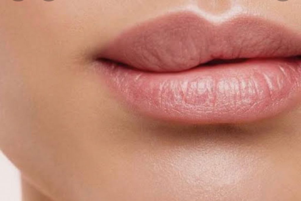 Edema Tardio Intermitente Persistente - RETOEDU